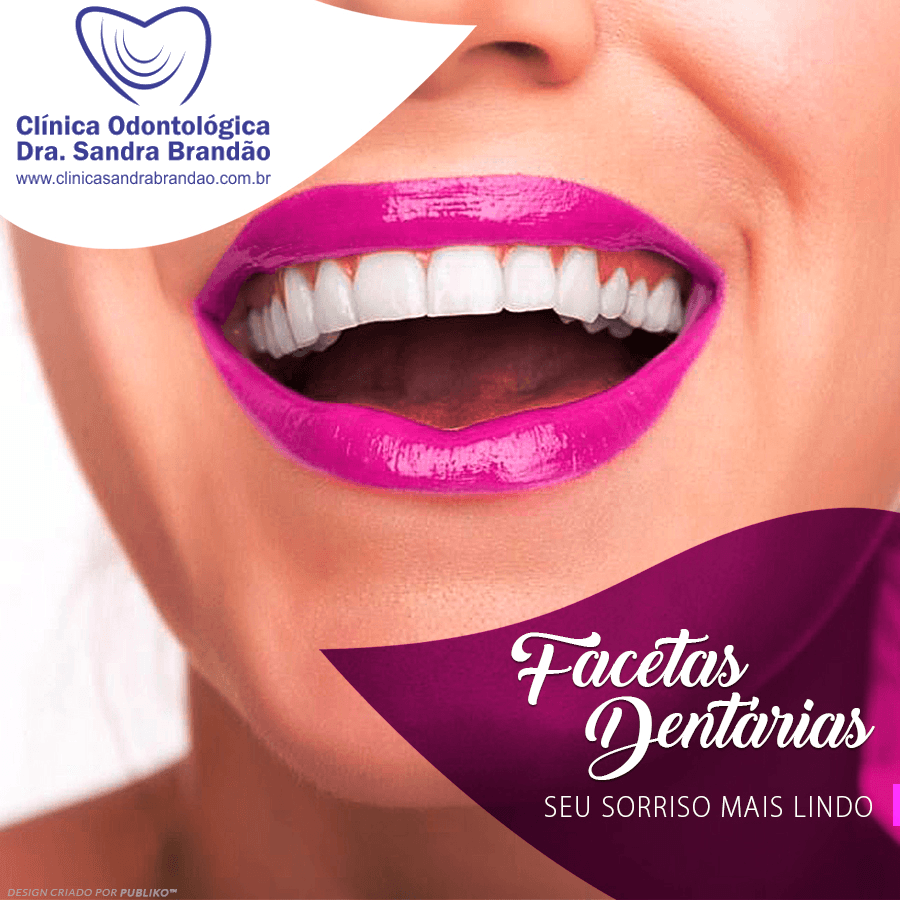 130-facetas-dentarias-cor-21192741549.png – Clínica Odontológica Dra ...