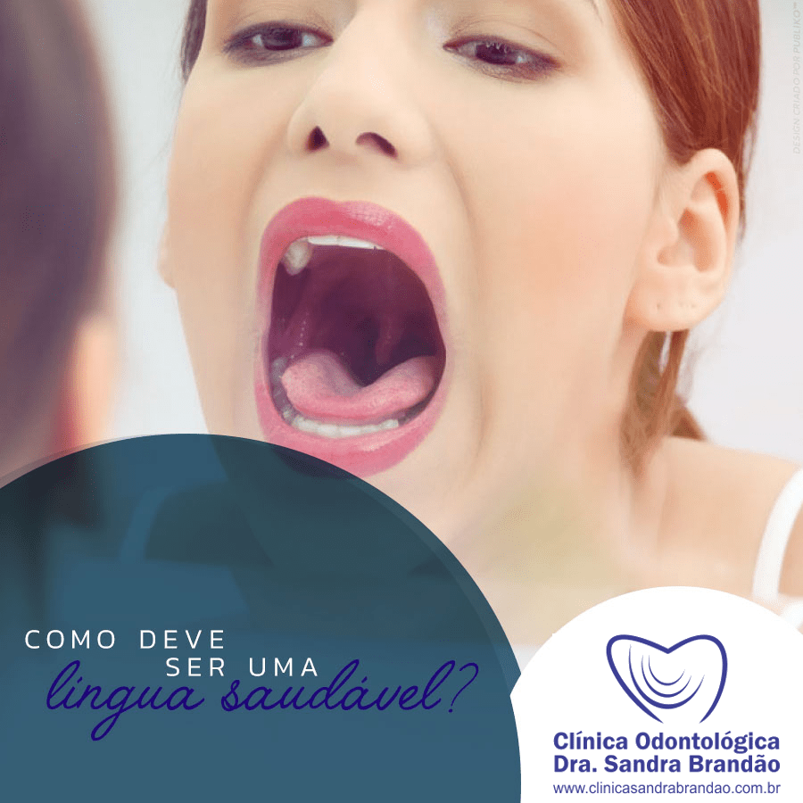 Língua Saudável – Clínica Odontológica Dra. Sandra Brandão