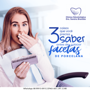3 coisas que você precisa saber antes de colocar facetas de porcelana ...