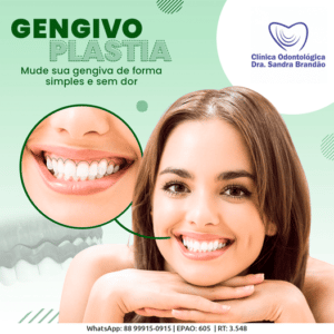 Mude sua Gengiva de Forma Simples e Sem Dor – Clínica Odontológica Dra ...
